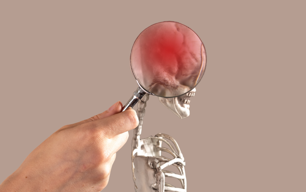 Commotion cérébrale : symptômes, diagnostic et traitement - ZIO - Santé ...